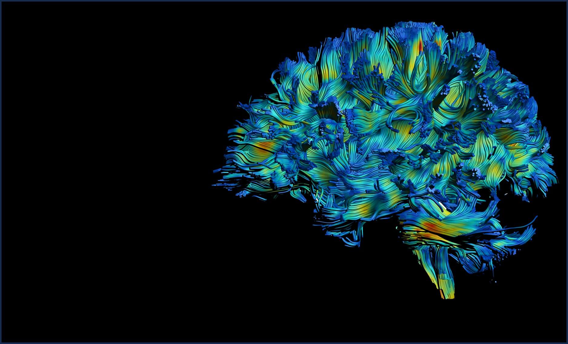 Advanced MRI and Radiology | The Brain & Performance Centre